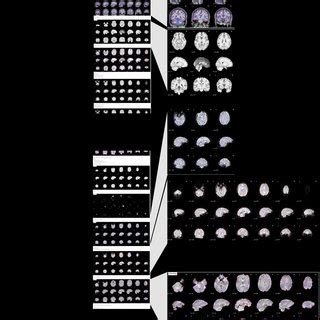 PDF FMRIPrep A Robust Preprocessing Pipeline For Functional MRI