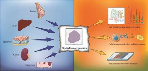 Novel Insights From Spatial Transcriptome Analysis In Solid Tumors