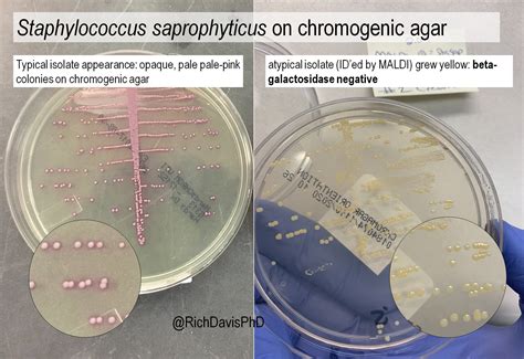 Staphylococcus Saprophyticus Colony Morphology