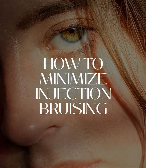 How To Minimize Injection Bruising