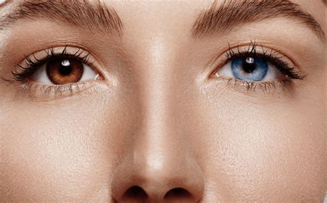 Different Colored Eyes Heterochromia