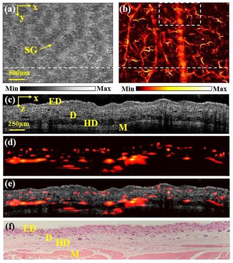Simultaneous In Vivo Imaging Of A Nude Mouse Hindlimb A OCT MIP Download Scientific Diagram