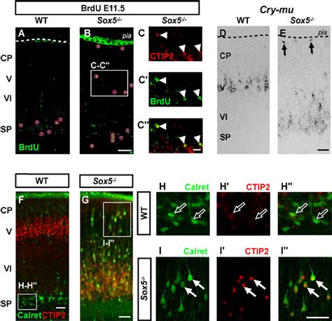 Sox5 À À Subplate Neurons Abnormally Differentiate Into Normally Download Scientific Diagram