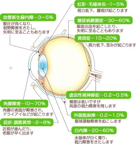 糖尿病と眼の合併症糖尿病網膜症 com糖尿病網膜症 糖尿病性網膜症 眼科 検査 治療 失明 東京都立川市 岩瀬眼科医院が運営