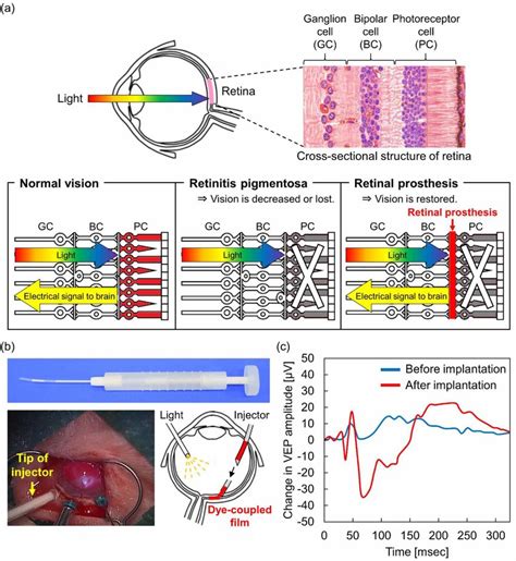 A Structure Of Retinal Tissues And Visual Information Processing