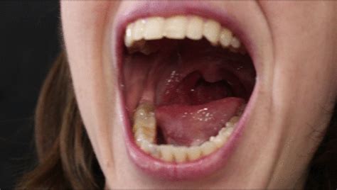 Andrea Sky Yawning So Tired