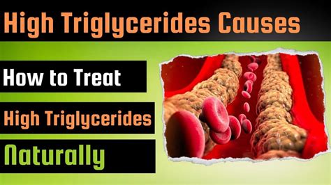 How To Treat High Triglycerides Naturally YouTube