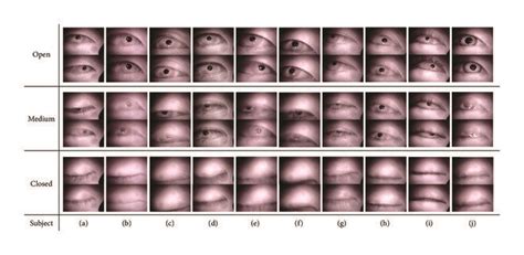 Sample Eye Images From Our Dataset Download Scientific Diagram