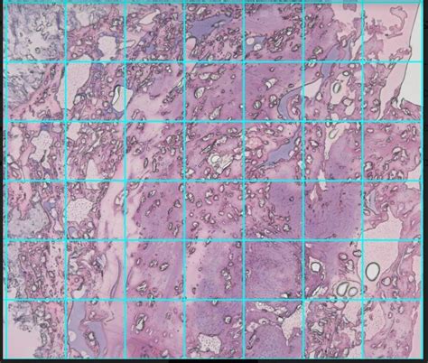 Solved Classify The Tissues Under Each Intersection Of Lines