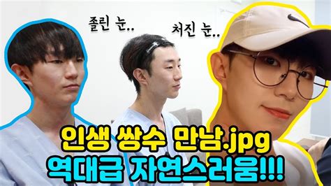 남자 쌍수 후기 저 첫 성형했어요 쌍꺼풀 완전절개 눈매교정 수술 리얼 후기🤩 무쌍에서 속쌍으로 처진 눈 졸린 눈을 시원하고 또렷하게 👀[쀼] Youtube