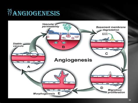 Development Of Cancer Cells Etiology Classification Staging Of