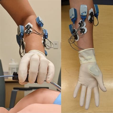 Electromyography Sensors On The Left Forearm While Manipulating The Download Scientific Diagram