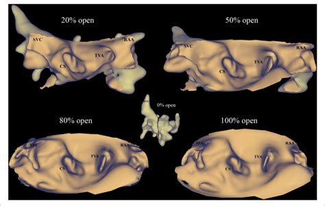 Pano View Of The Kodex Epd System The Anatomical Image In The Kodex