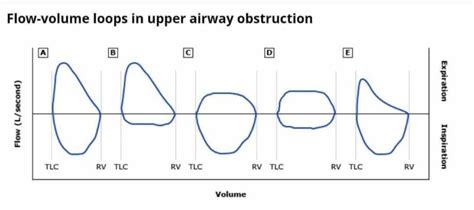 Review In Pulmonary Function Test Flow Volume Loops A Normal Flow Volume Loop The Expiratory