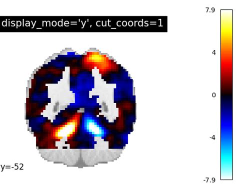 More Plotting Tools From Nilearn Nilearn