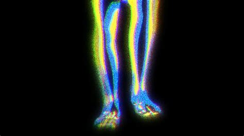 Ren Dobson On Linkedin Motiondesign Motiongraphics