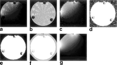 Figure 2 From Sense Sensitivity Encoding For Fast Mri Sensitivity Encoding With Cartesian