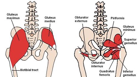 Gluteal Tendinopathy Physioworks