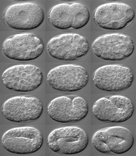 Unusual Labmates How C Elegans Wormed Its Way Into Science Stardom Whitehead Institute