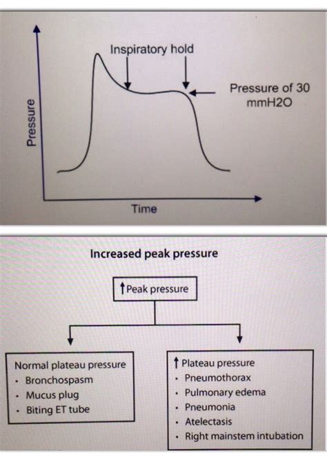 Ventilator Problems And Troubleshooting An Overview 2024 Artofit