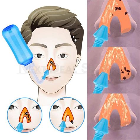 Sinus Rinse Bottle 300ml