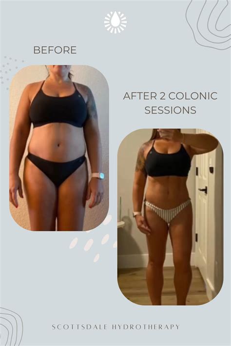 Hydrotherapy Artofit