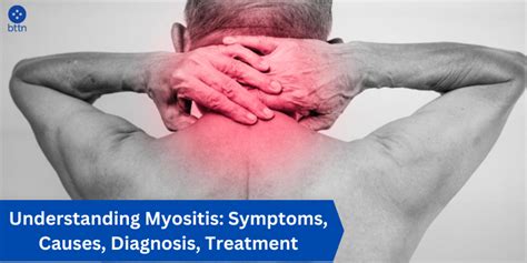 Myositis Symptoms Causes Diagnosis Treatment Bttn