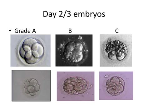 Oocyte And Embryo Grading Blastocyst Grading Pptx