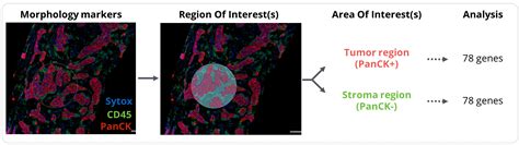 Spatial Transcriptomics Reveals Key Determinants Of Response To Immune Checkpoint Blockade In