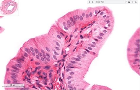 Solved Simple Columnar Epitheliumlabel The Nucleus