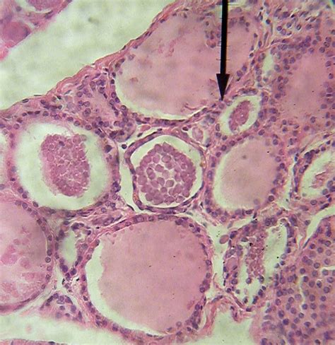 Simple Squamous Qr Code Tissue Lab