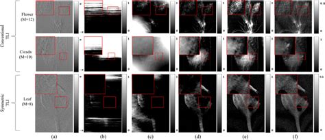The X Ray Grating Interferometer Comparison Results A Dpci B Download Scientific Diagram