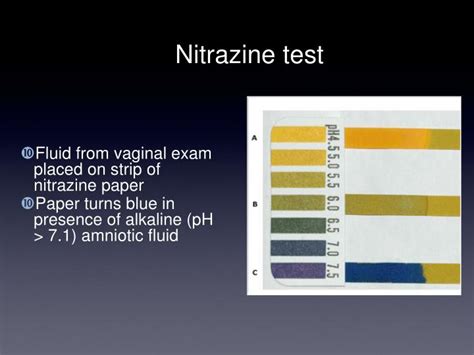 Ppt Preterm Labor And Prom Powerpoint Presentation Id4740589