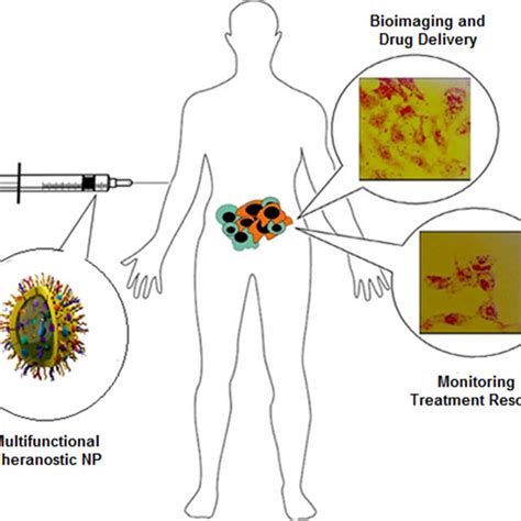 1 Concept Of Epr Effect For Tumor Targeted Drug Delivery Adapted From Download Scientific