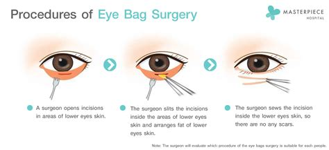 Cosmetic Procedure For Under Eye Bags At Velma Huffman Blog