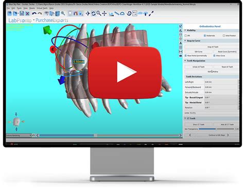 New On Demand Course 7ce Credits Clear Aligners Design And