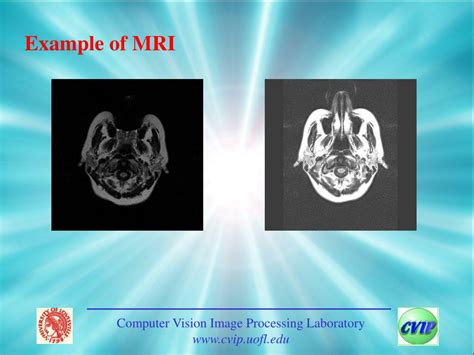 Ppt Detection Visualization And Identification Of Lung Abnormalities In Chest Spiral Ct