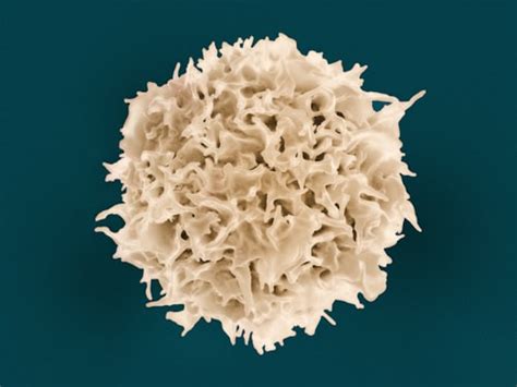 The Ultimate Guide To Teratocarcinoma