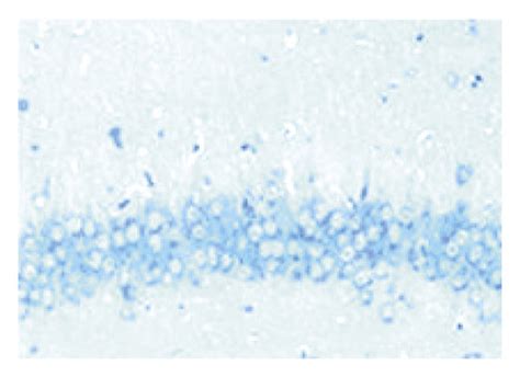 Influence Of Texture Parameters On Friction Factor At Different Download Scientific Diagram