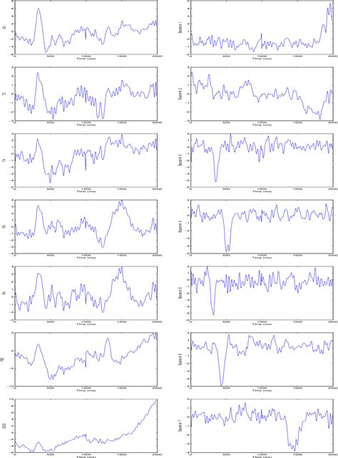 Figure 4 From Artifact Removing From Eeg Recordings Using Independent Component Analysis With