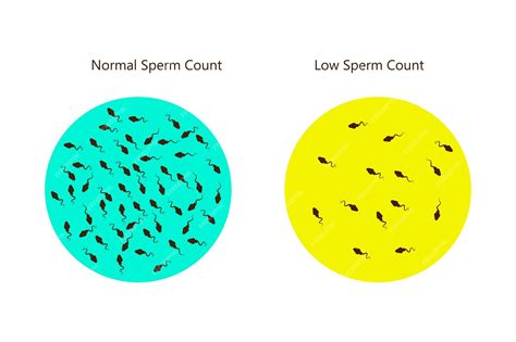 Premium Vector Normal And Low Sperm Count Illustration Male Infertility Oligospermia Structure