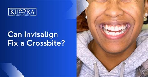 Crossbite Braces Before After