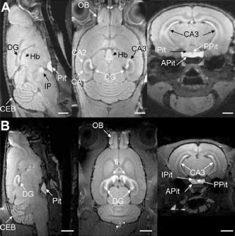 Figure 1 From Detection Of Cortical Laminar Architecture Using Manganese Enhanced Mri Semantic