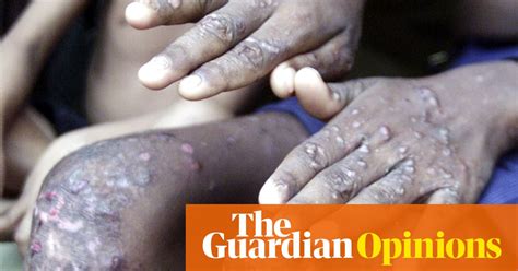 Arsenic In Bangladesh How To Protect 20 Million From The Worlds