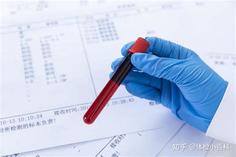 血常规白细胞高是白血病吗三个指标异常请进一步筛查 知乎