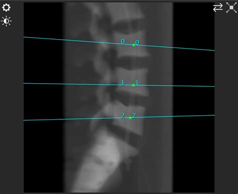 Xray 2d 3d Registration — Imfusion Suite Documentation