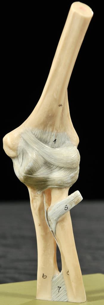 CHAP 8 JOINTS ELBOW JOINT Diagram Quizlet