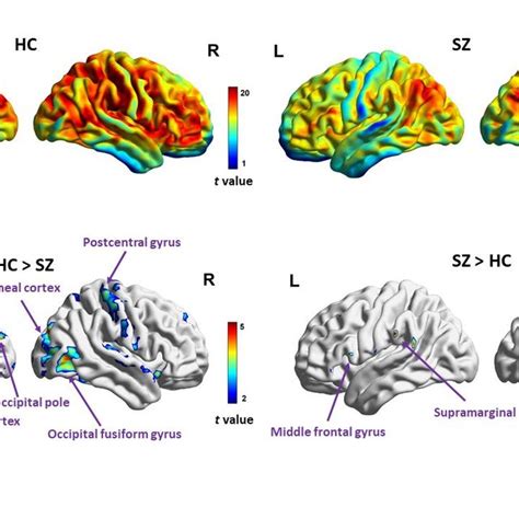 Mass Univariate Exploratory Analysis P Uncorr
