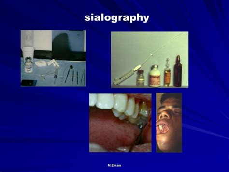 Common Syndromes Affecting The Head And Neck Ppt