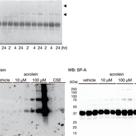 The Expression Of Acrolein Modified Sp A In Mouse Lungs After 1 Week Of